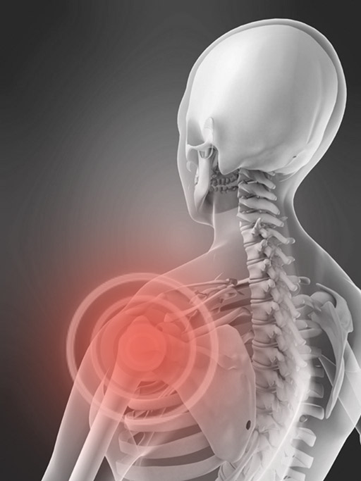 Treating Shoulder Injuries - Burton Physio Group Ltd